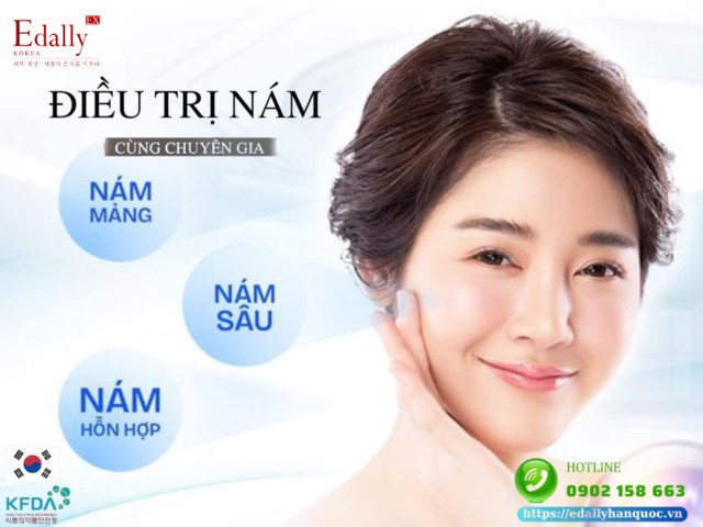 Cách Nhận Biết Nám Da Và Điều Trị Nám Da Từ Góc Nhìn Của Chuyên Gia