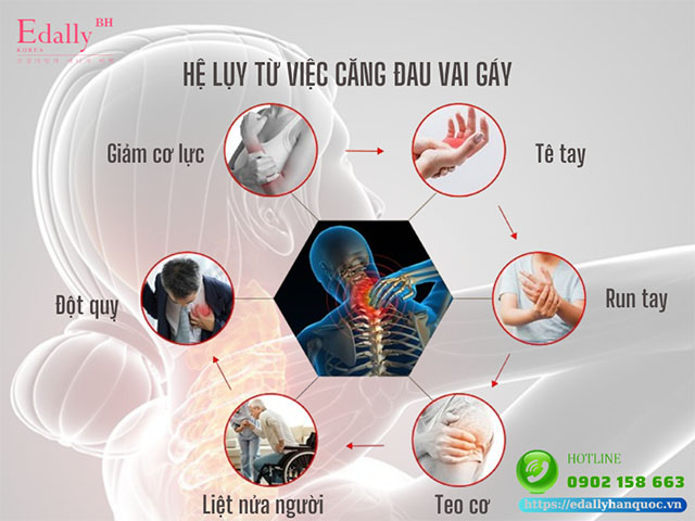 Hội Chứng Căng Đau Vai Gáy - Nguyên Nhân, Triệu Chứng, Cách Phòng Ngừa